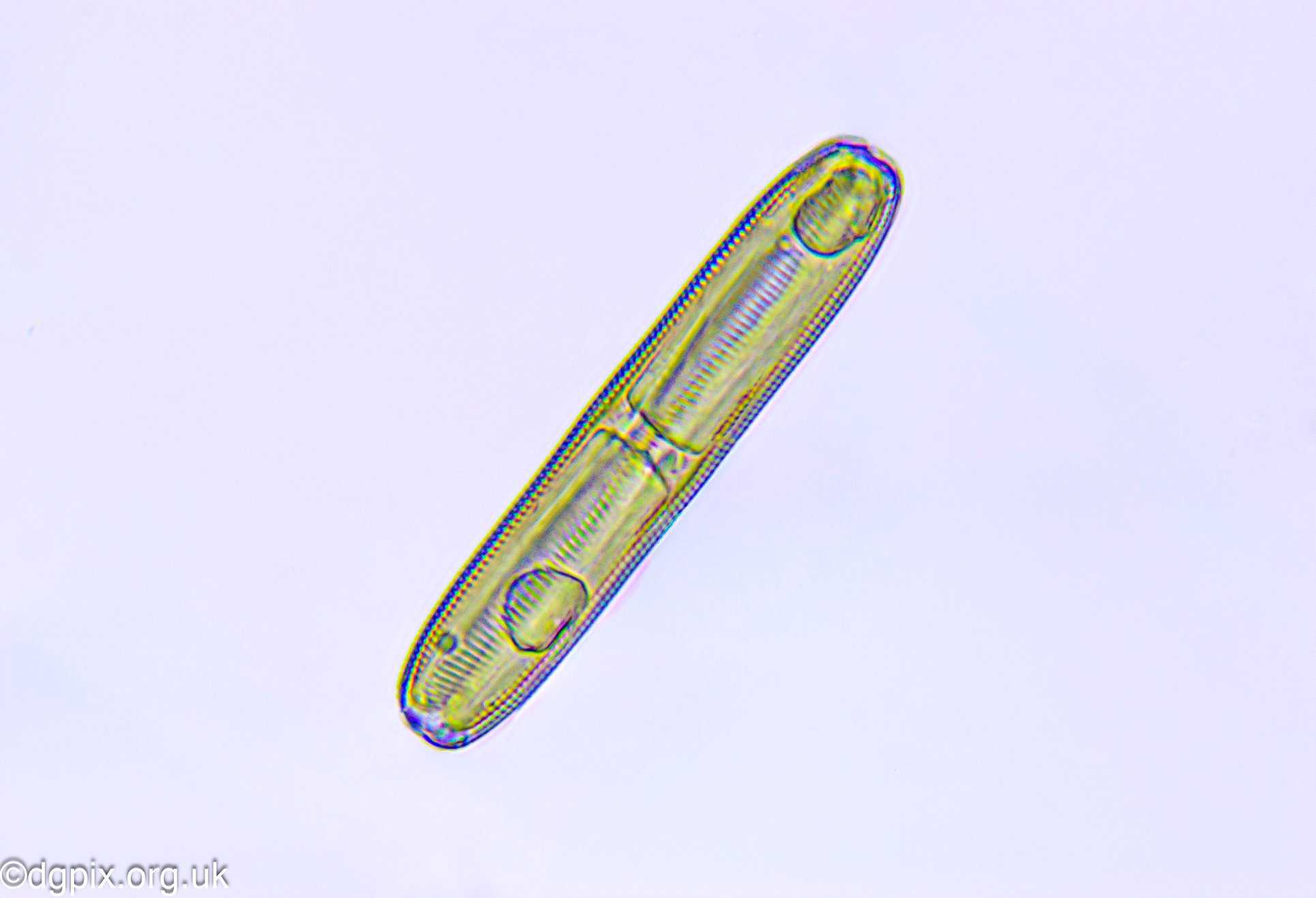 The Diatoms of Brackagh Bog